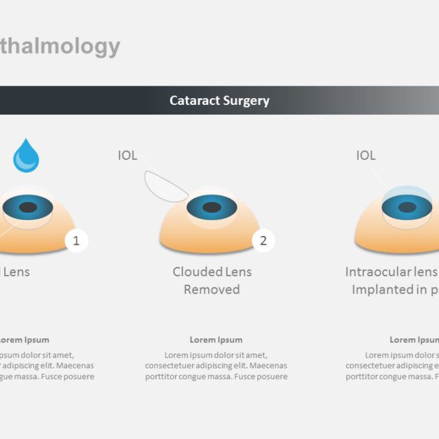 Ophthalmology PowerPoint Template